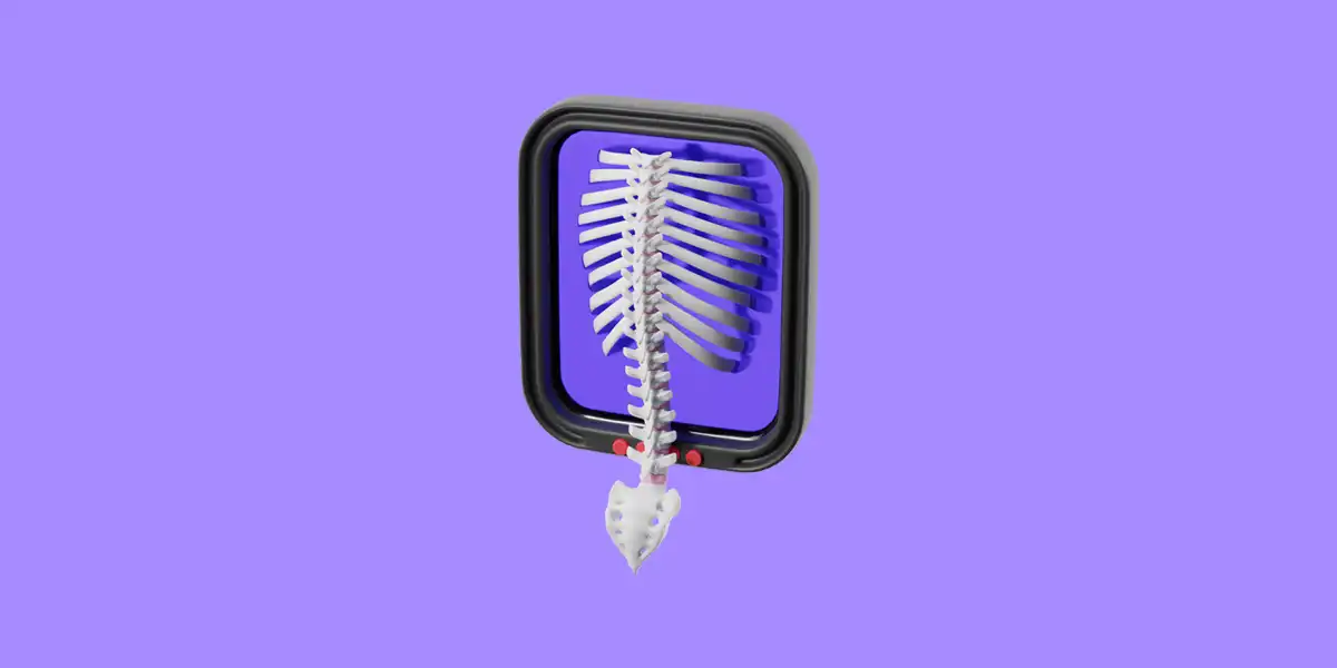 Spinal Stenosis Treatment in Iran | Mortaz Hospital Yazd